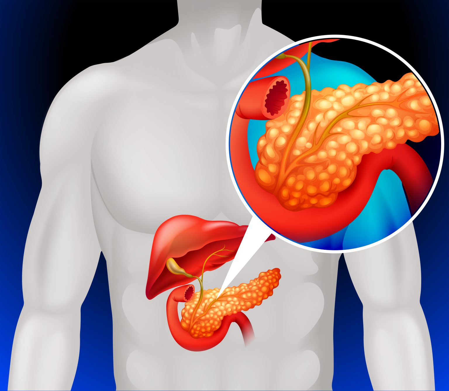 Biliary Reconstruction